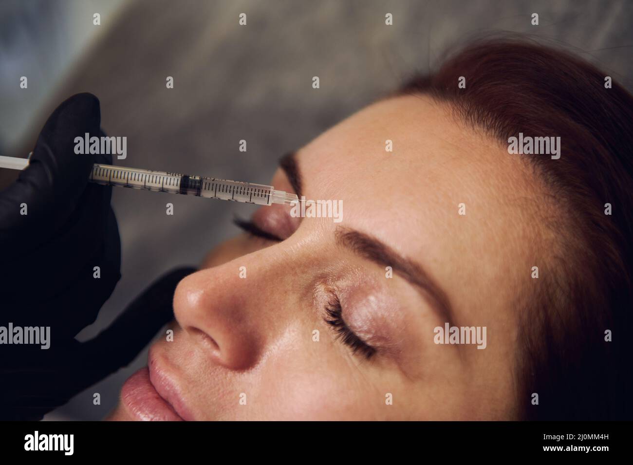 Botulinum toxin injection hi-res stock photography and images - Alamy