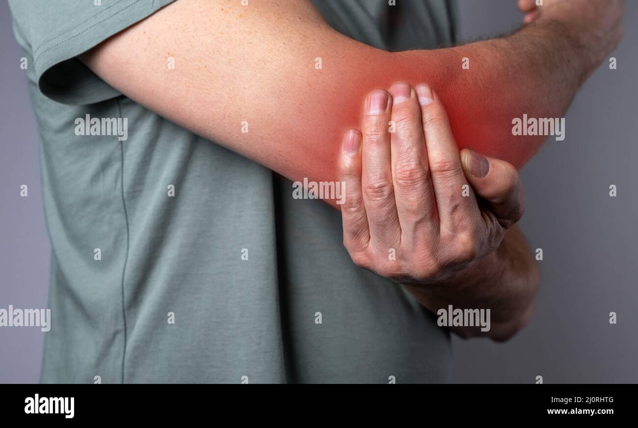 Elbow joint dislocation hi-res stock photography and images - Alamy