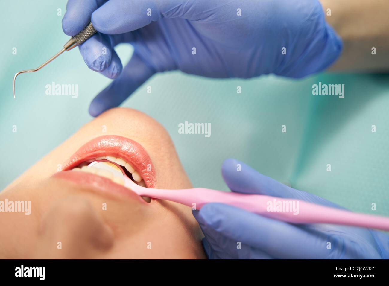 Dentist examining woman teeth with dental mirror and explorer Stock ...