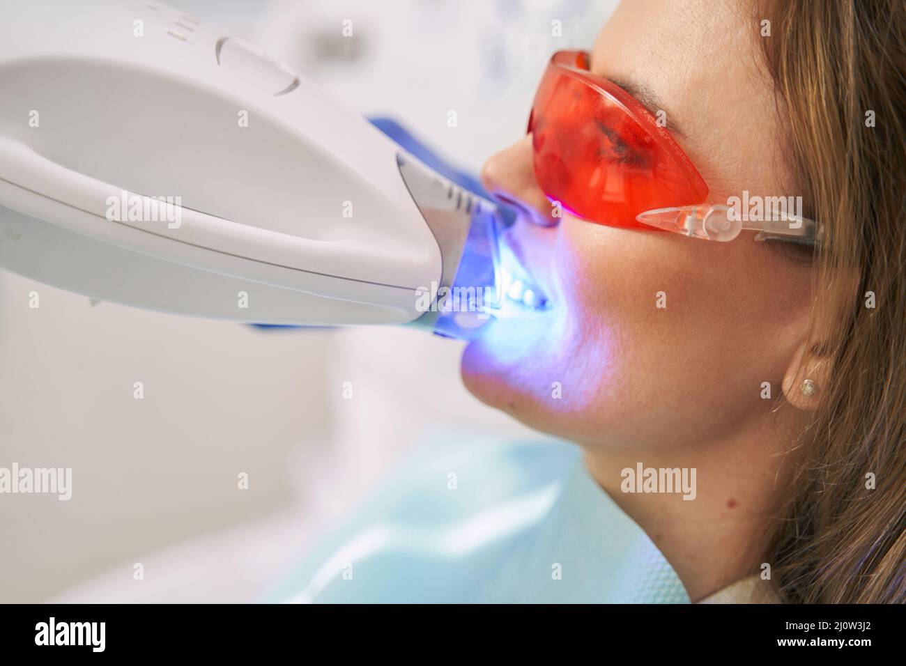 Woman having laser teeth whitening procedure in stomatology clinic ...