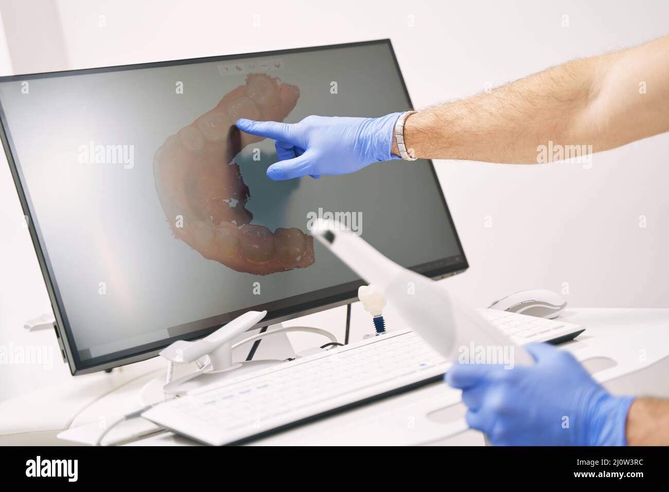 Male dentist hand pointing at computer display with dental 3D scan ...