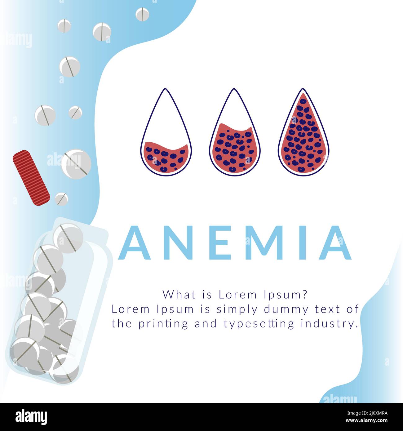 A concept on the topic of anemia. The difference Anemia number of red ...