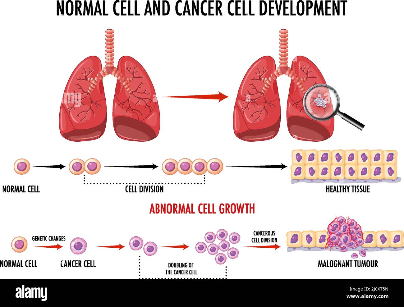 Diagram showing normal and cancer cells illustration Stock Vector Image ...