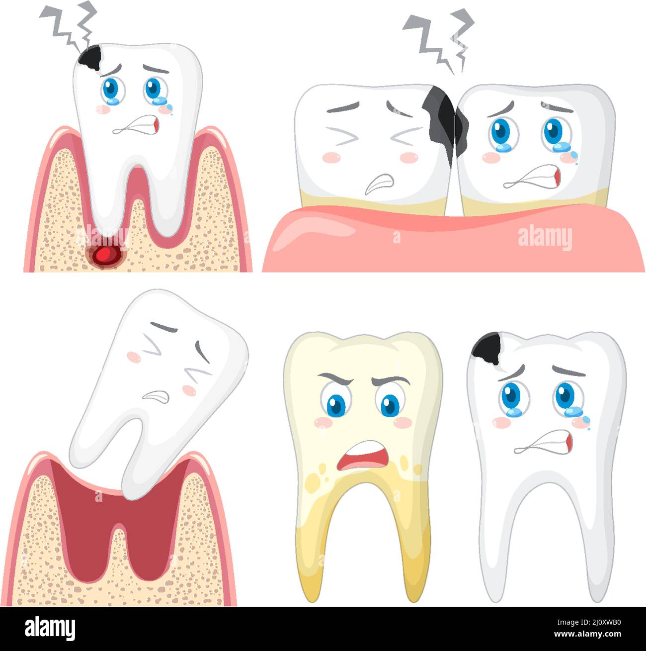 Set of teeth decay on white background illustration Stock Vector Image ...