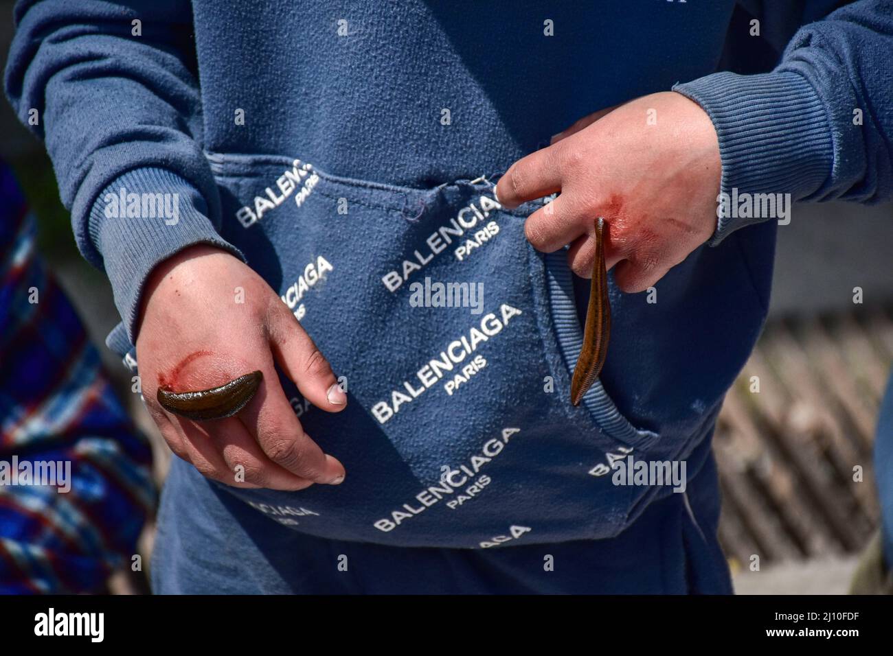 Srinagar, India. 21st Mar, 2022. A patient receives leech therapy ...