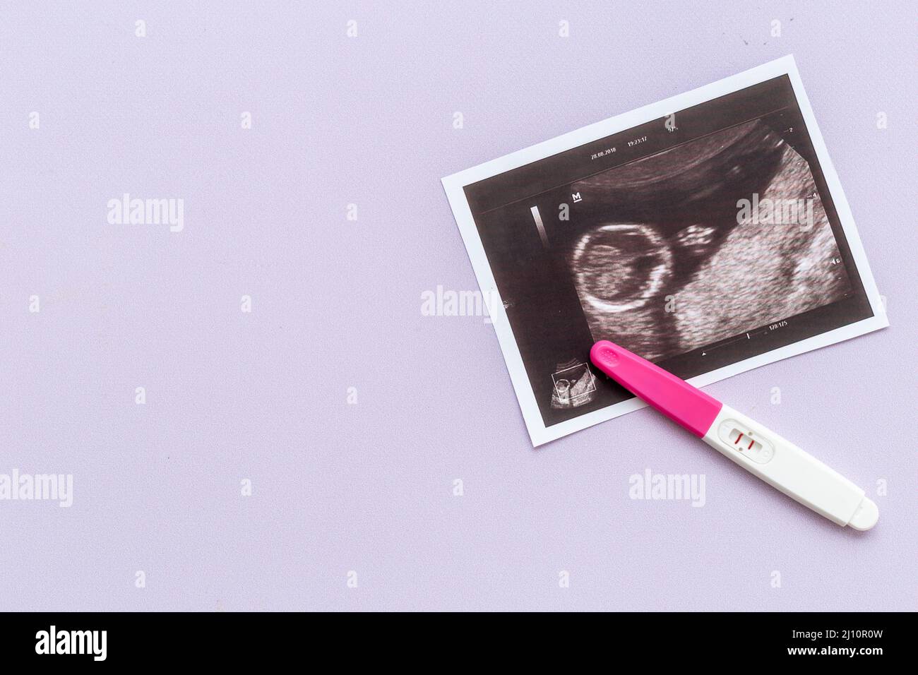 Prenatal ultrasound screening of unborn baby. Pregnancy background ...