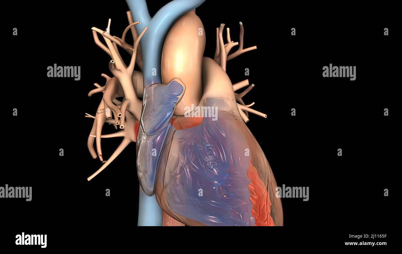 Sinoatrial Node High Resolution Stock Photography and Images - Alamy