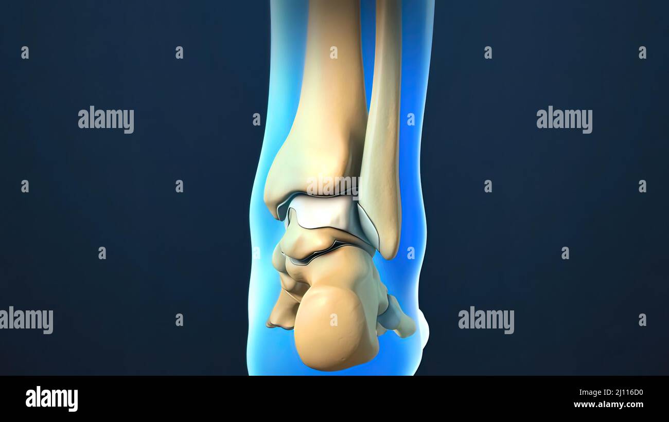 Bone Spurring High Resolution Stock Photography and Images - Alamy