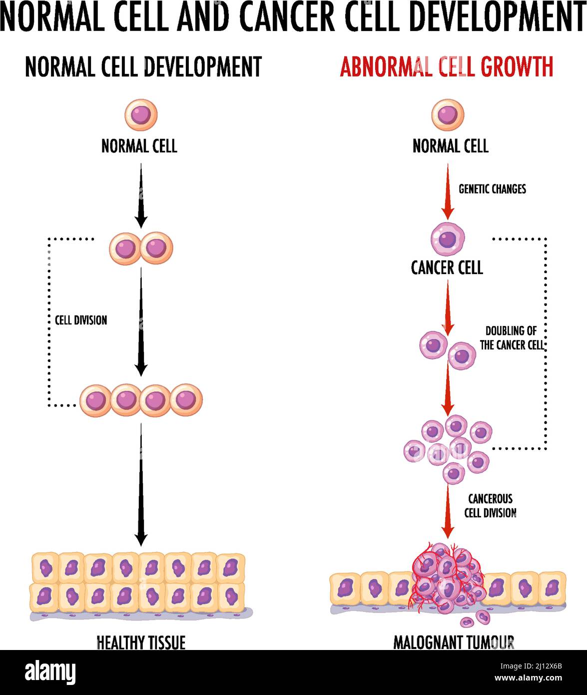 Diagram showing normal cell and cancer cell illustration Stock Vector ...