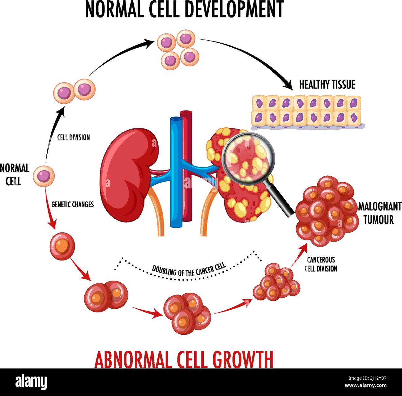 Diagram showing normal and cancer cell illustration Stock Vector Image ...