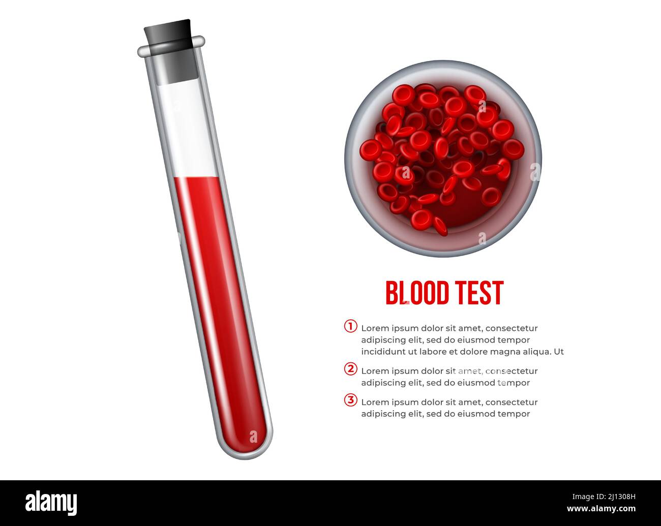 Realistic medical glass test tube with red blood cells. Medicine poster ...