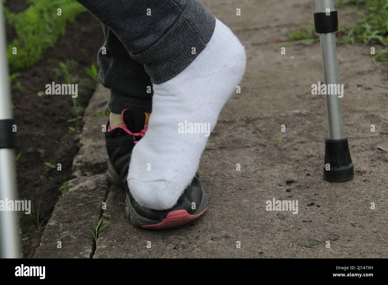 People With Broken Leg