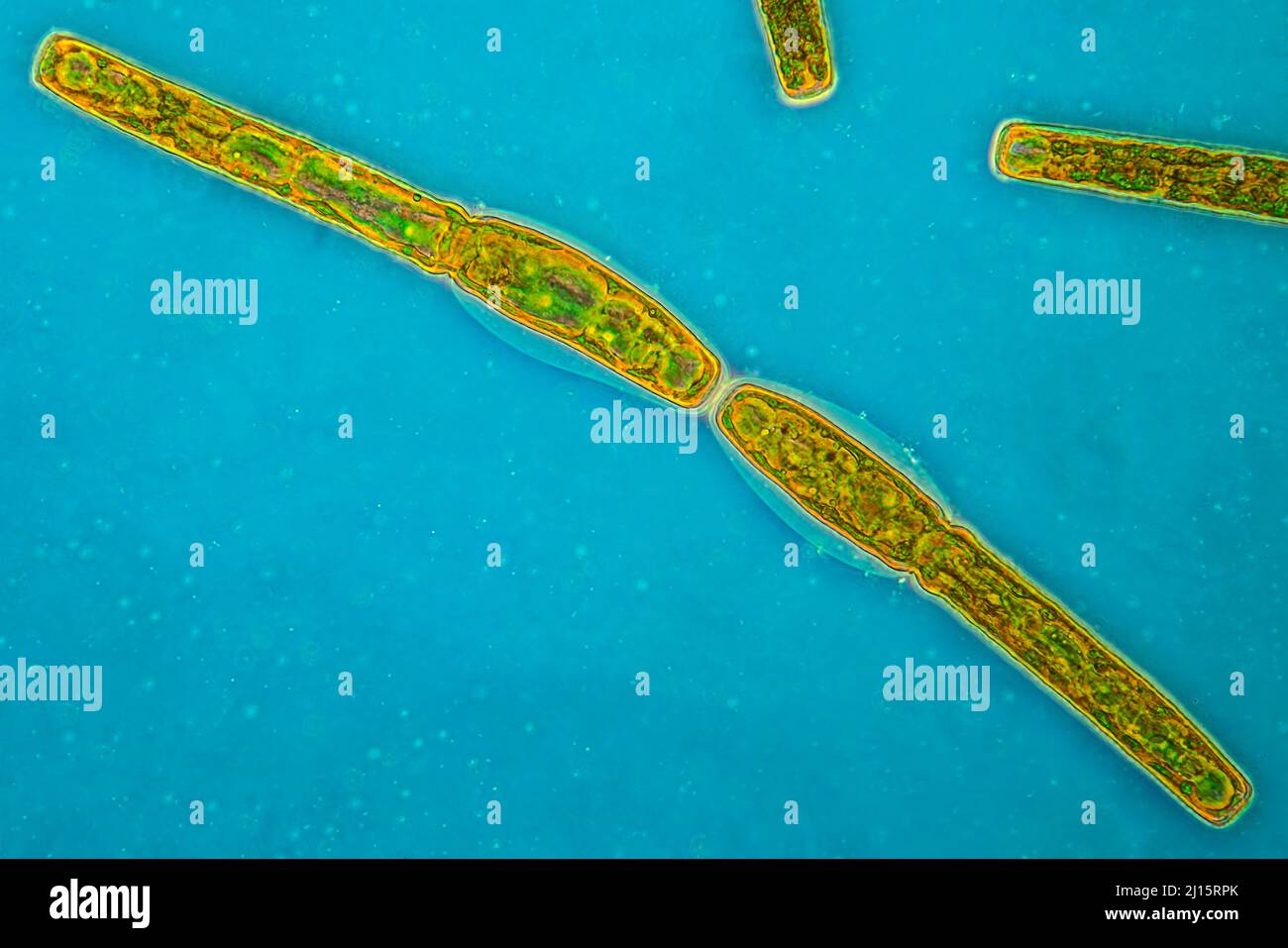 Pleurotaenium ehrenbergii algae, light micrograph Stock Photo - Alamy