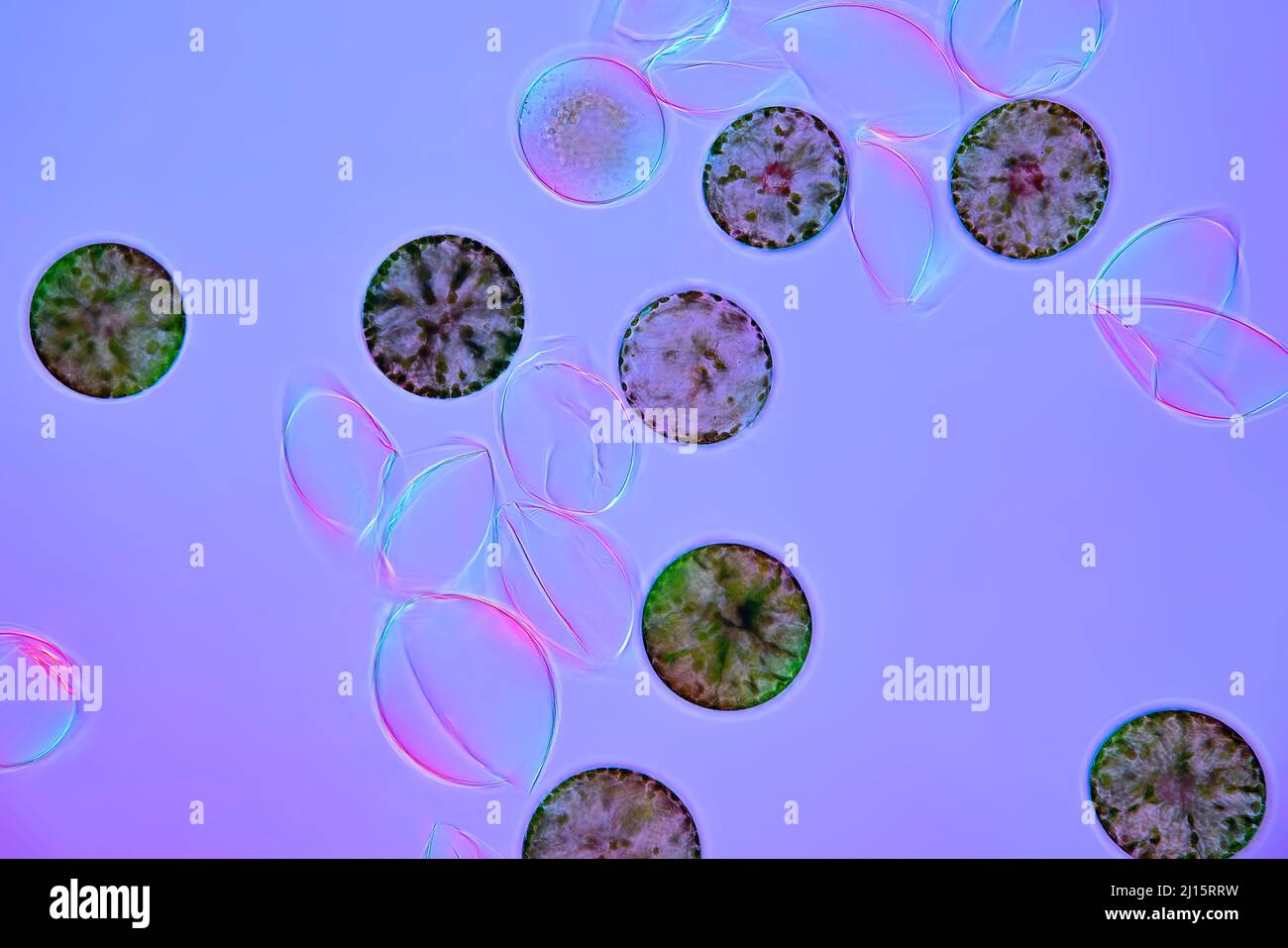 Eremosphaera viridis algae, light micrograph Stock Photo - Alamy