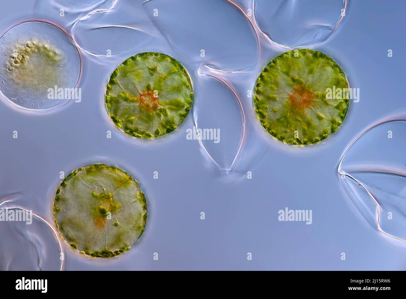Eremosphaera viridis algae, light micrograph Stock Photo - Alamy