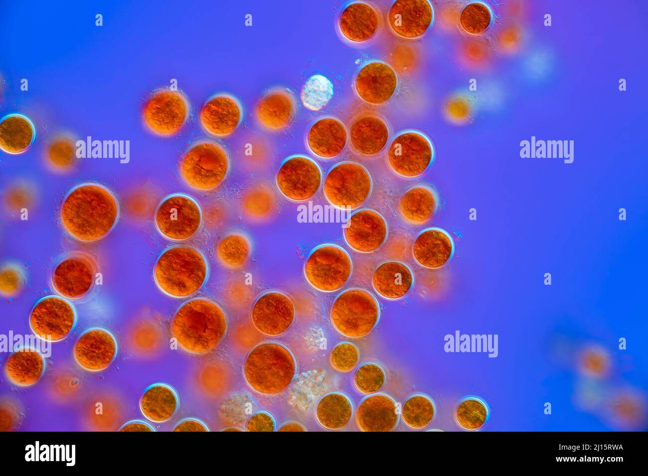 Haematococcus sp., algae, light micrograph Stock Photo - Alamy