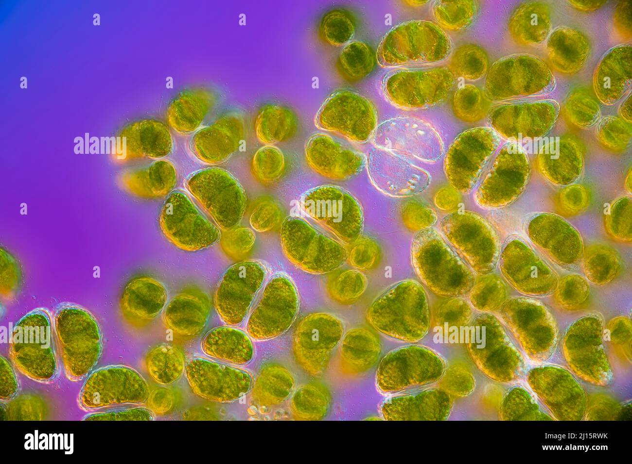 Staurastrum muricatum algae, light micrograph Stock Photo - Alamy