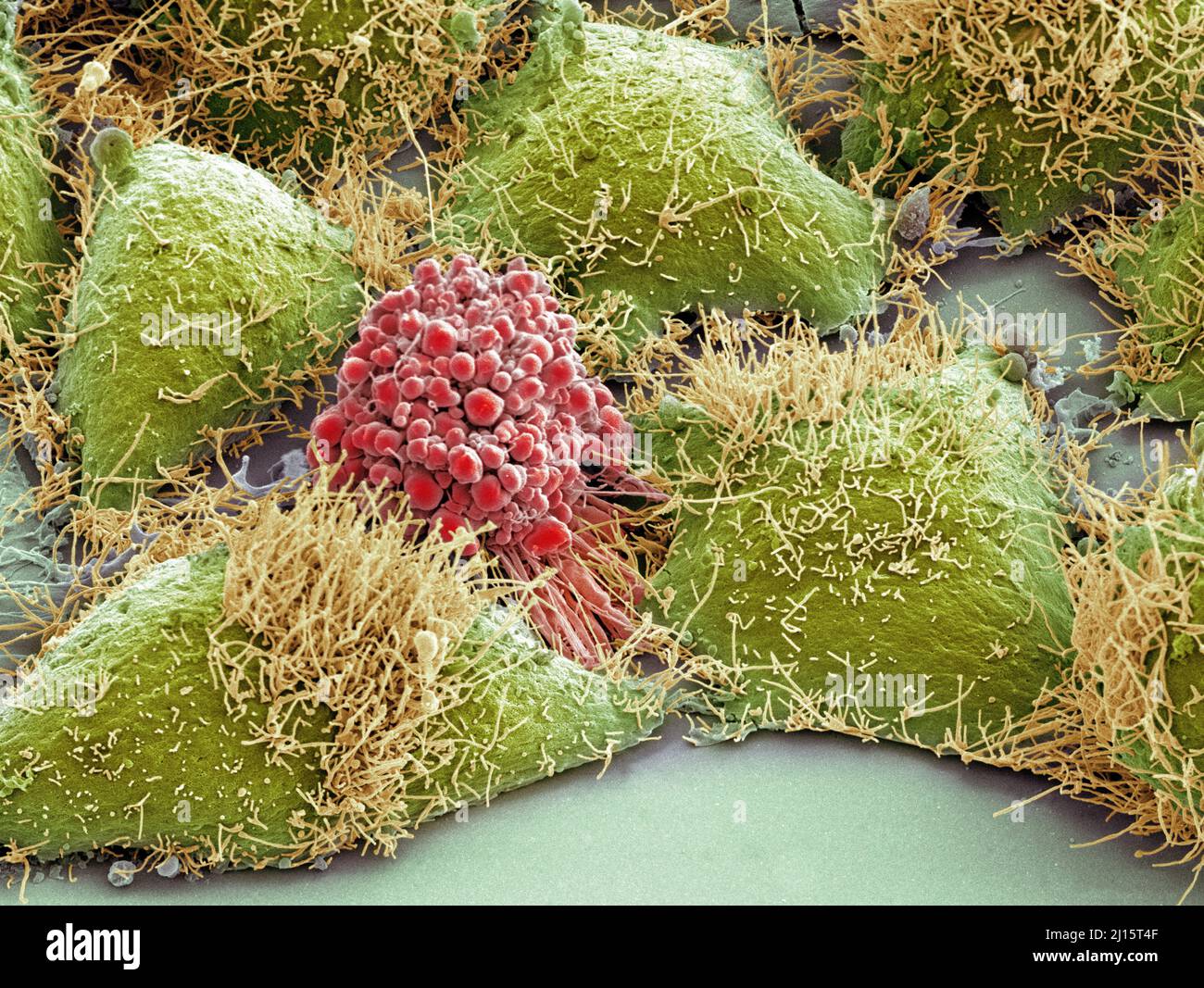 HeLa cells, SEM Stock Photo - Alamy