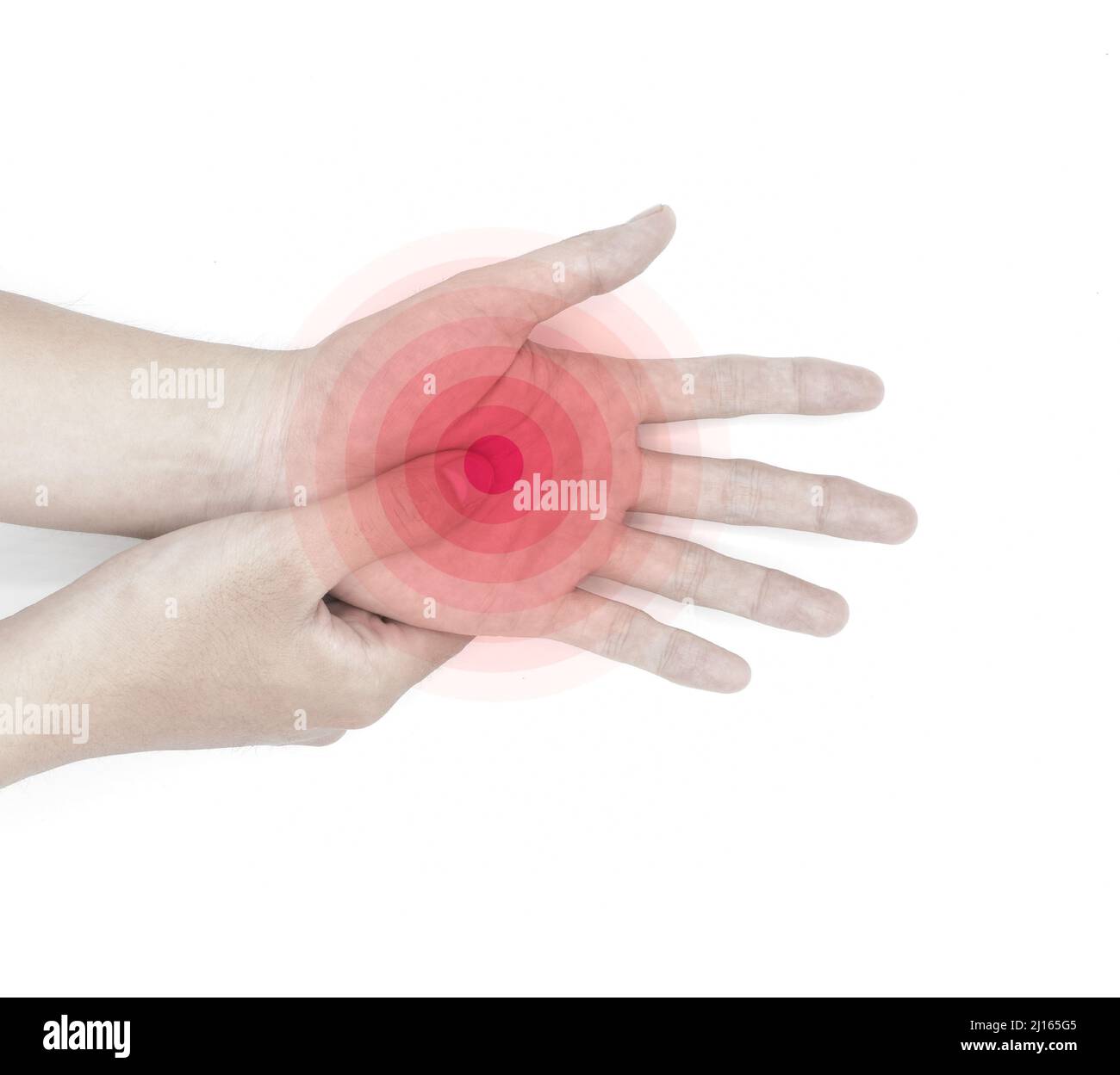 Painful palmar aspect of Asian young man. Concept of compartment ...
