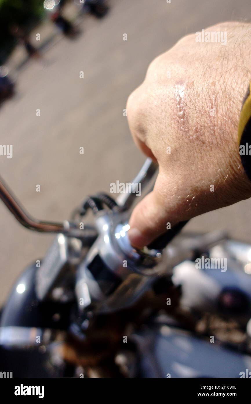 Hand with a scar on the handle of a motorcycle. Hand holds the gas ...