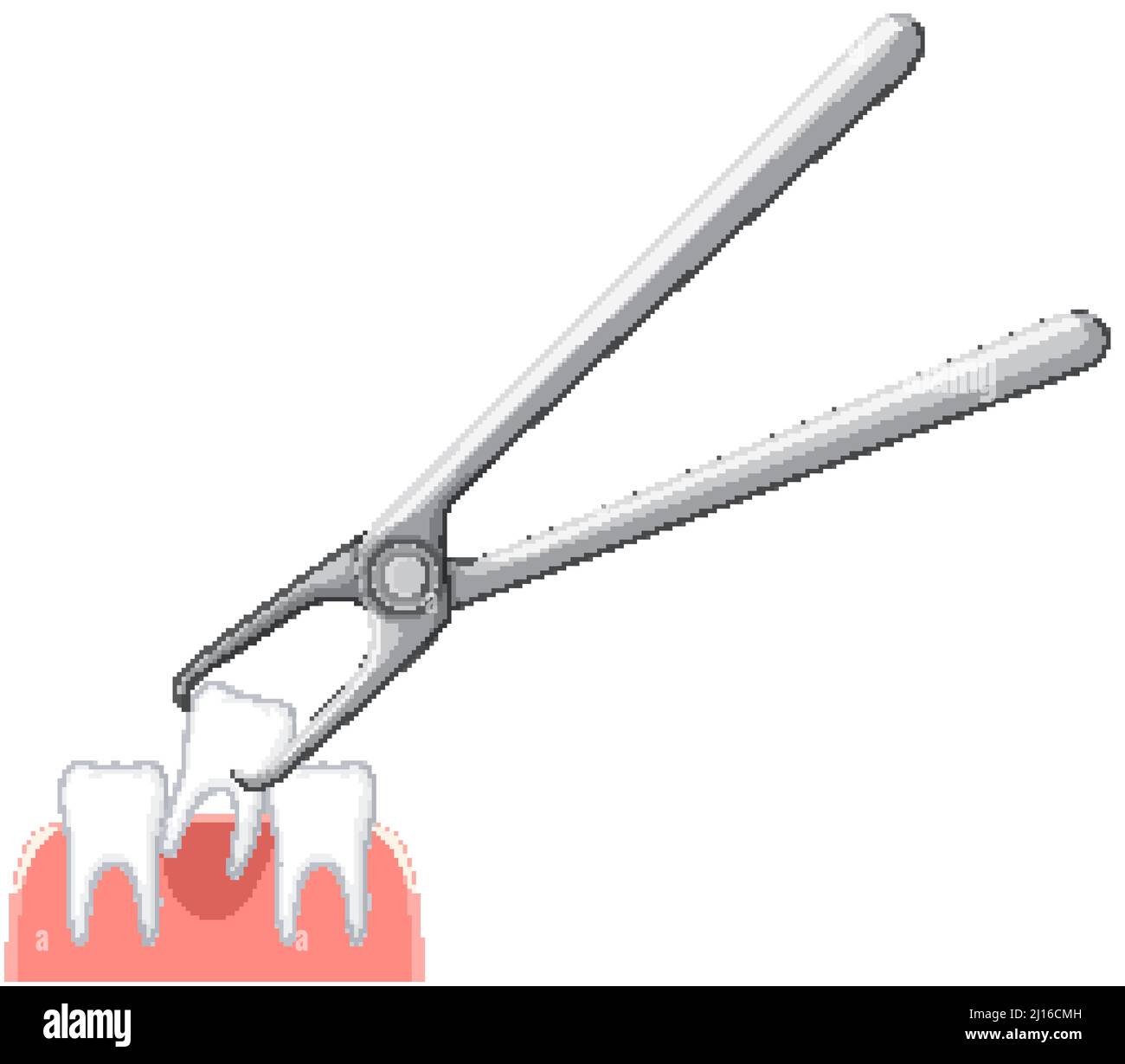 Cartoon teeth extraction on white background illustration Stock Vector ...