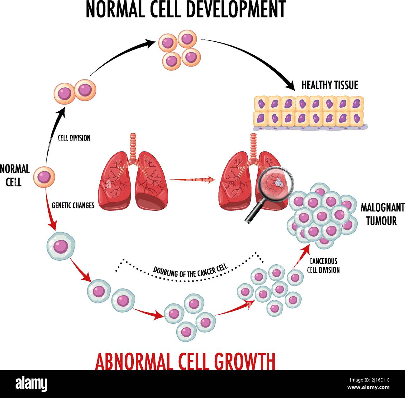Diagram showing cancer development process illustration Stock Vector ...