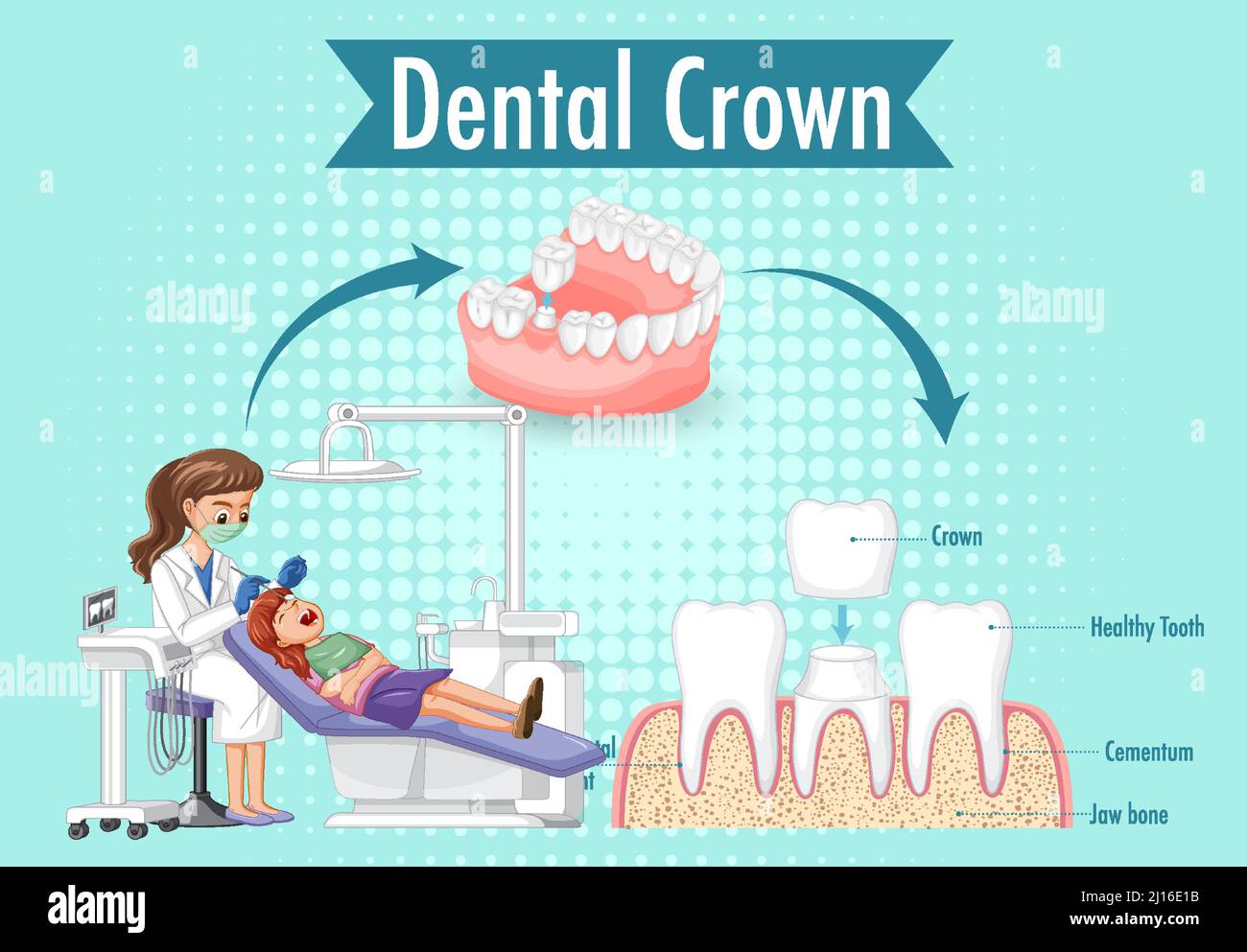 Infographic of human in dental crown illustration Stock Vector Image ...