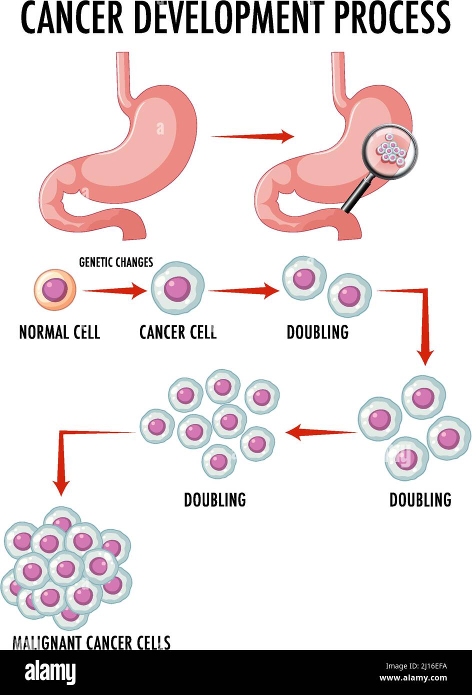 Diagram showing cancer development process illustration Stock Vector ...