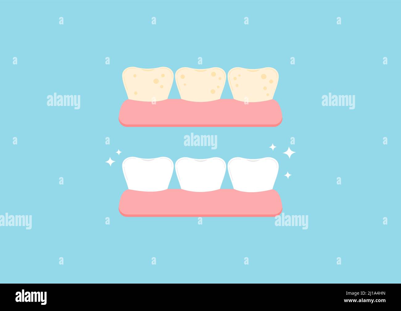 Tooth bleaching health and tooth with yellow plaque before, after icon ...