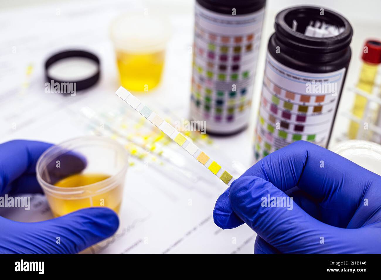 urine test, made with a vial of Urinalysis Reagent Strip used for ...