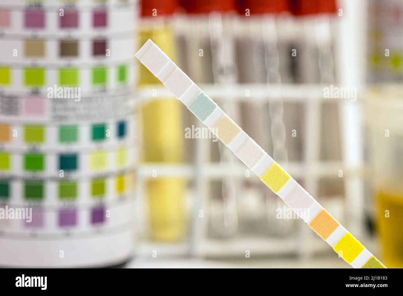 reagent strips used in urinalysis to analyze Leukocytes, Urobilinogen ...