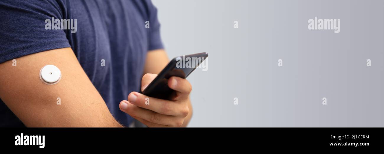 Man Testing Glucose Level With Continuous Glucose Monitor On Mobile ...