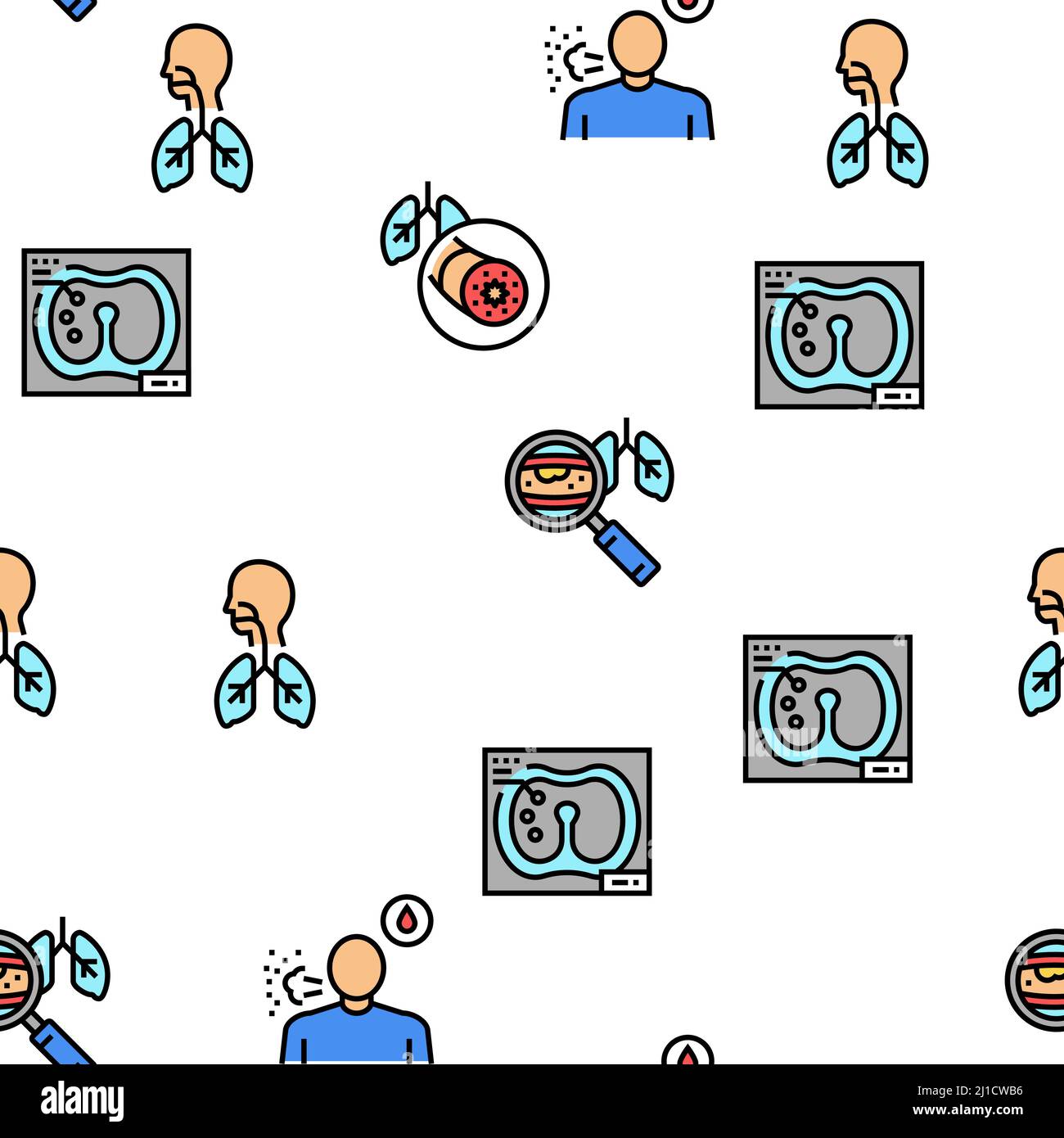 Respiratory distress syndrome lungs hi-res stock photography and images ...