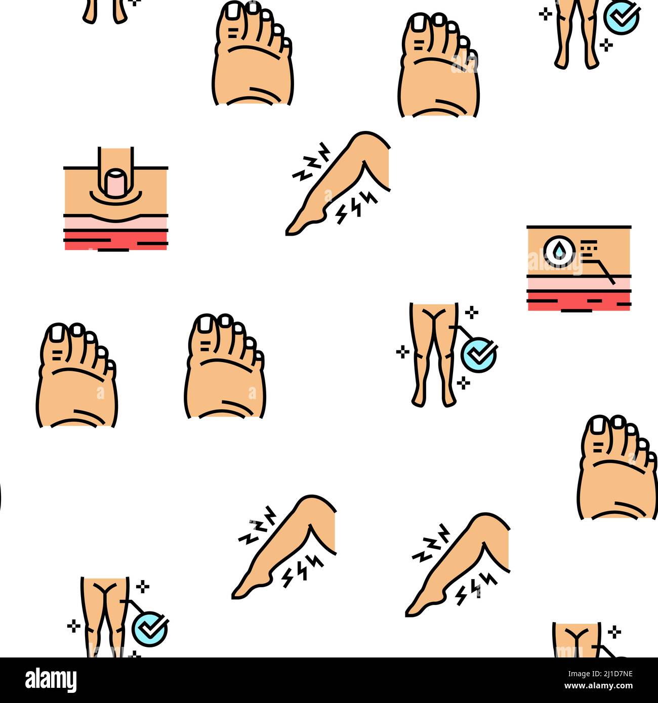 Edema Disease Symptom Vector Seamless Pattern Stock Vector Image & Art ...