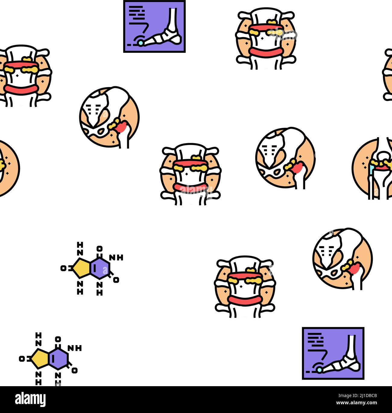 Gout Health Disease Vector Seamless Pattern Stock Vector Image & Art ...