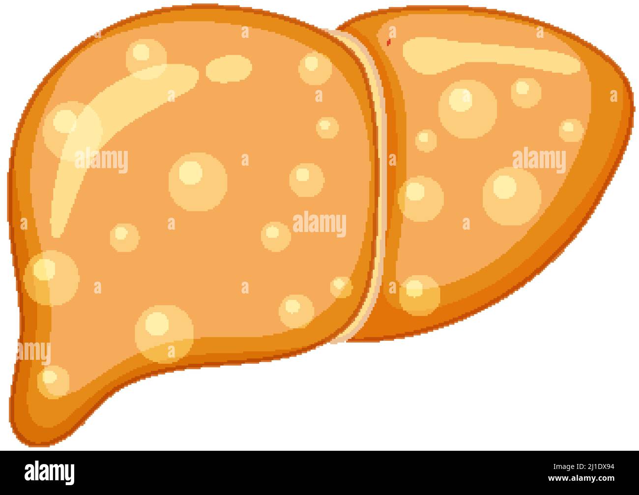 Fat Liver on white background illustration Stock Vector Image & Art - Alamy