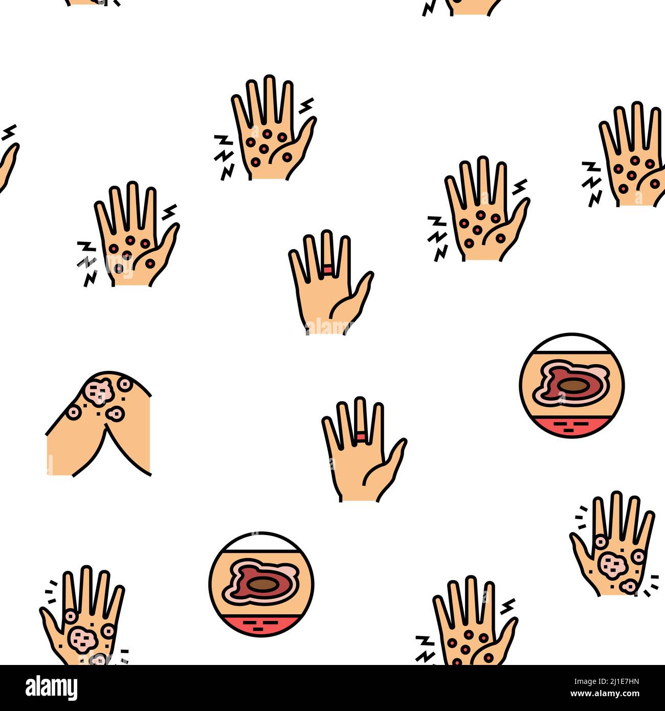 Eczema Disease Treat Vector Seamless Pattern Stock Vector Image And Art