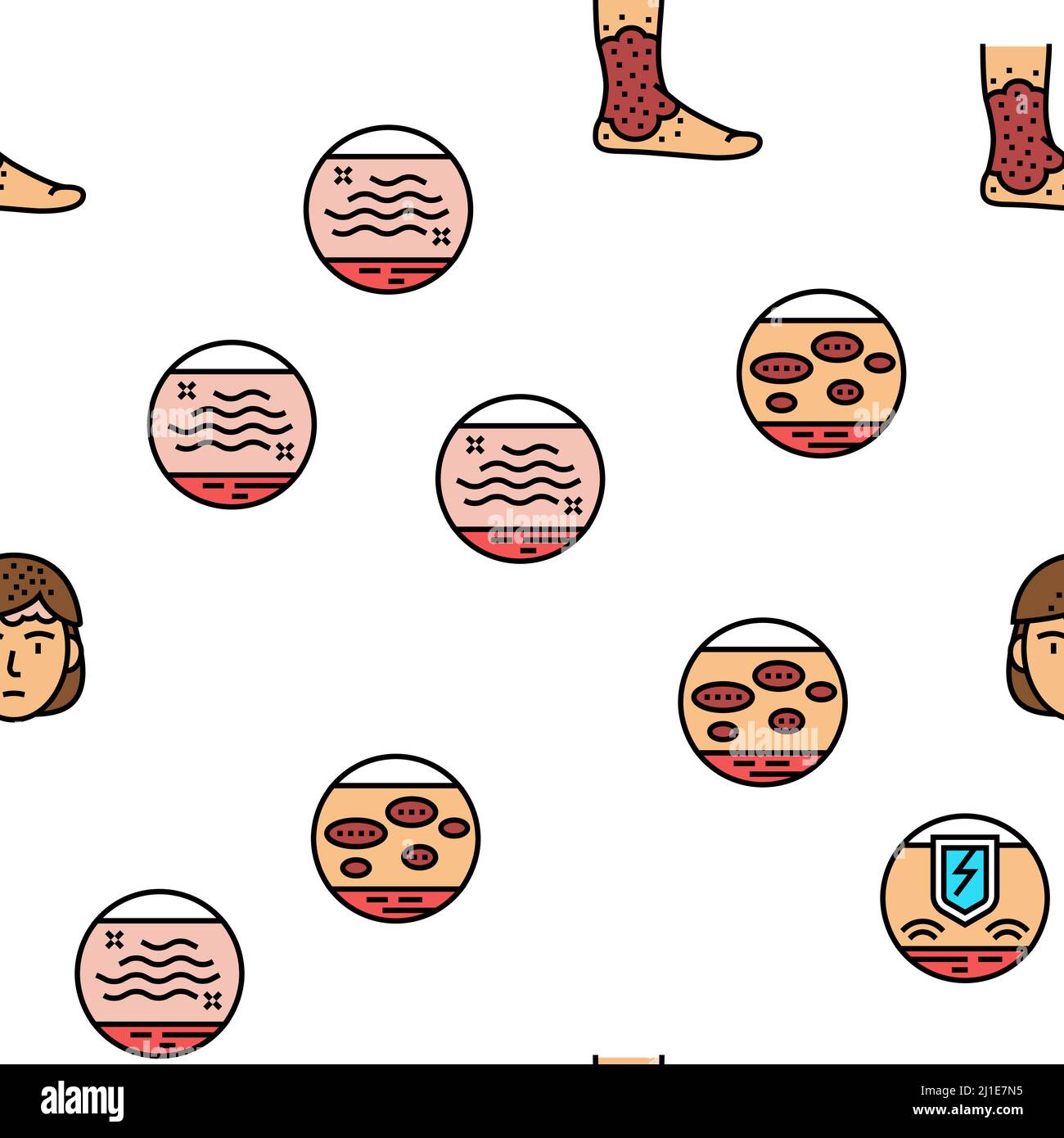Eczema Disease Treat Vector Seamless Pattern Stock Vector Image And Art