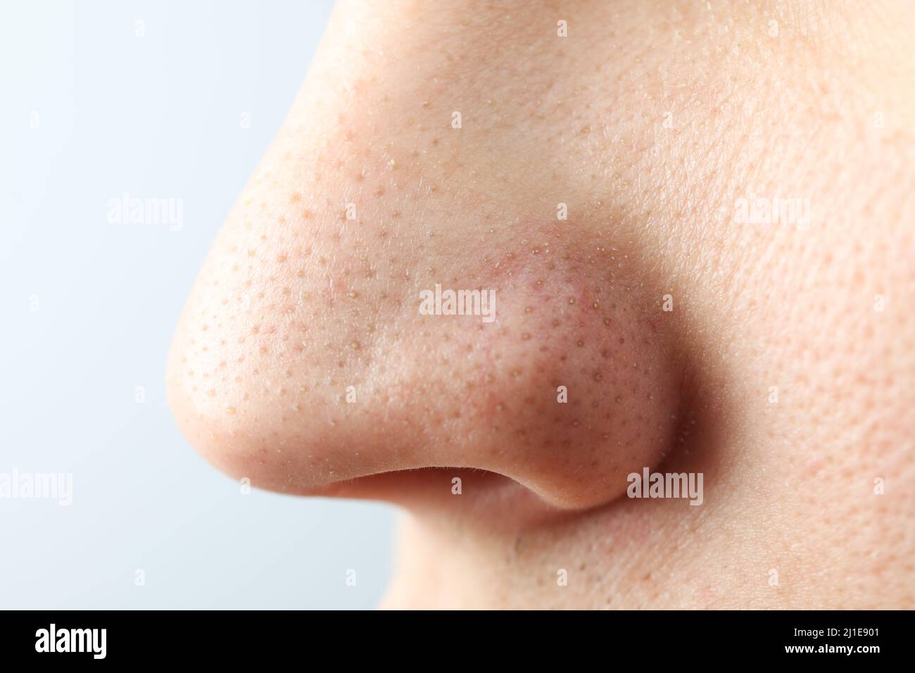 Concept of skin care with nose with dots Stock Photo - Alamy