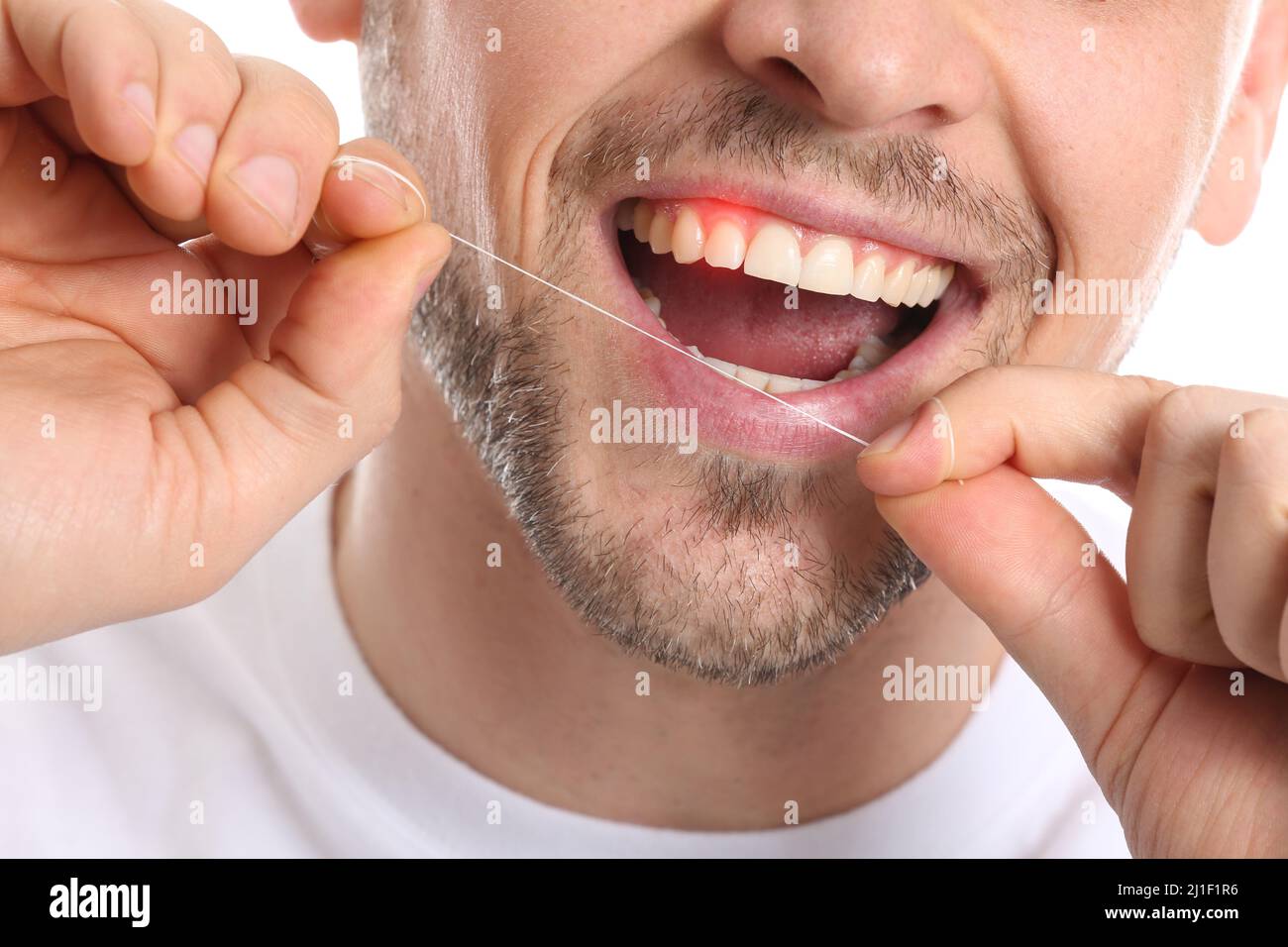 Man with gum inflammation flossing teeth, closeup Stock Photo - Alamy