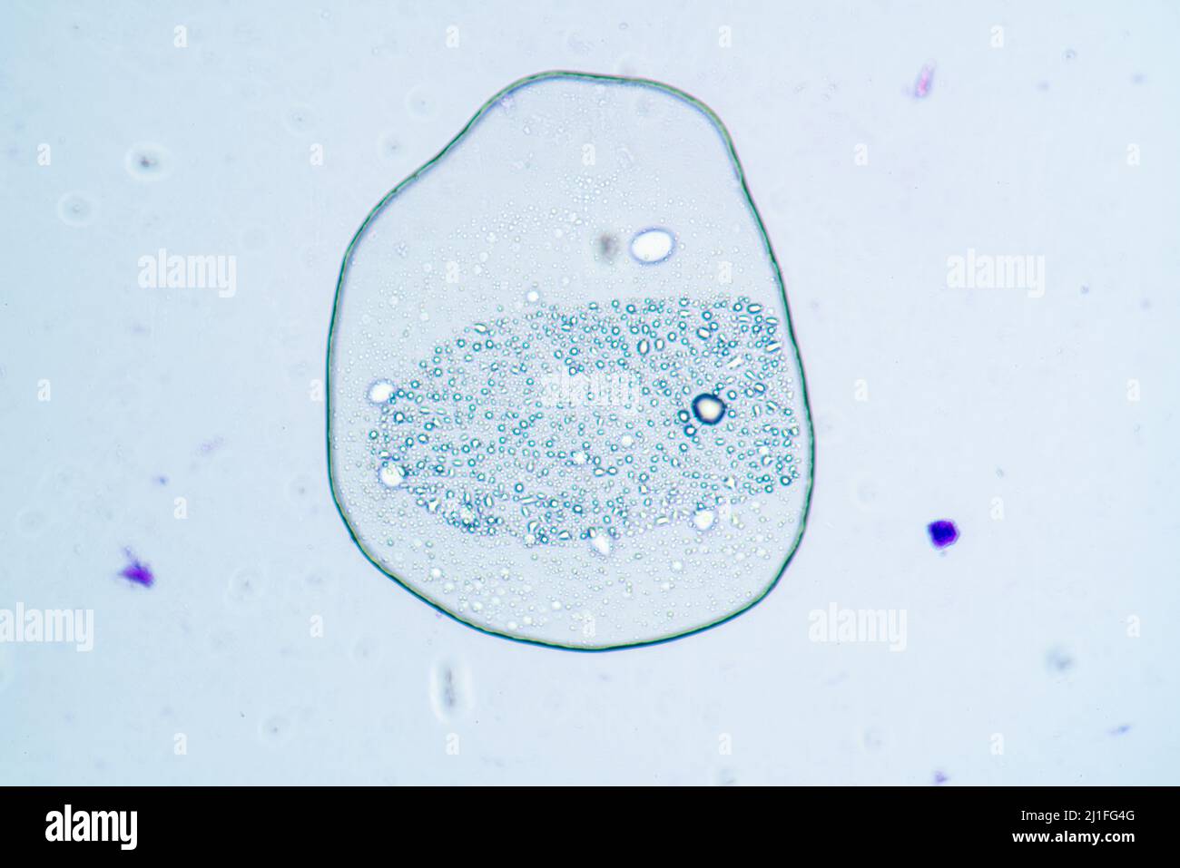 Biological fluid at a crime scene under a microscope as evidence of a ...