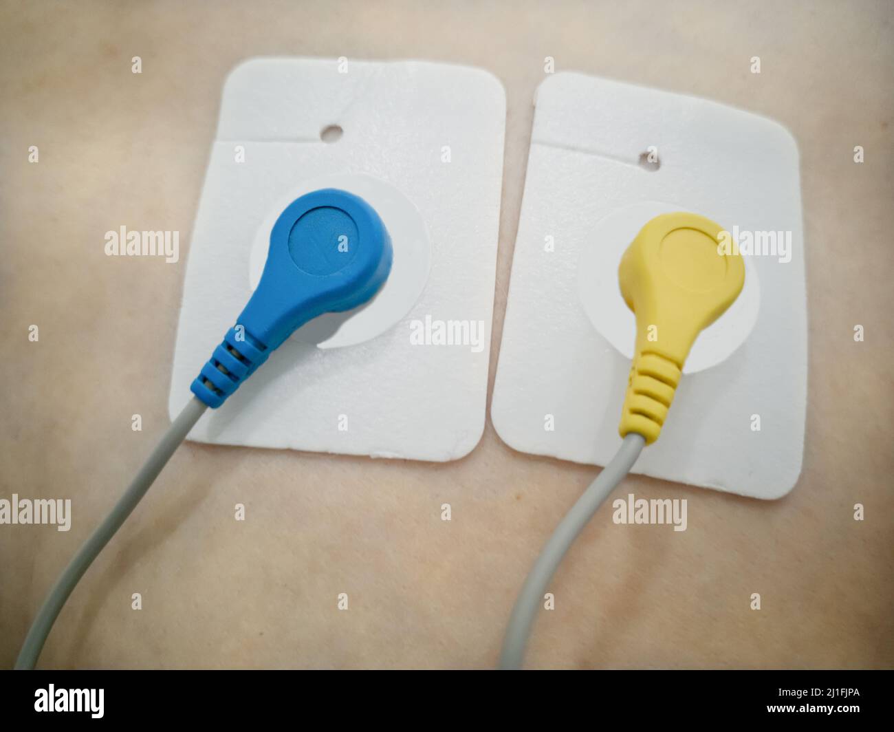 Holter monitoring. 24-hour ECG recording. Blue and yellow Holter ... Holter monitoring. 24-hour ECG recording. Blue and yellow Holter ...