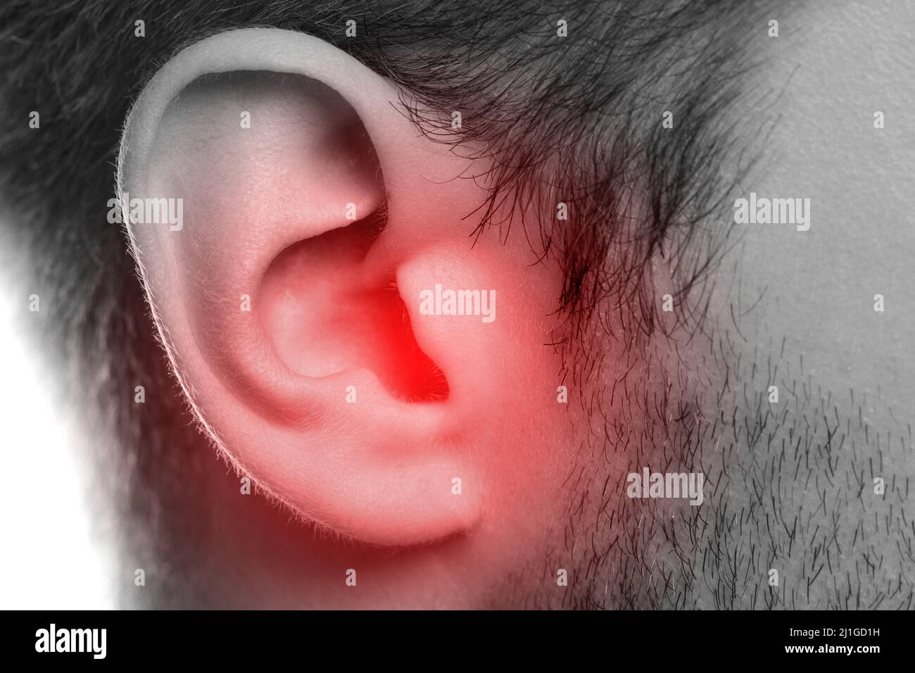 Eardrum otitis hi-res stock photography and images - Alamy