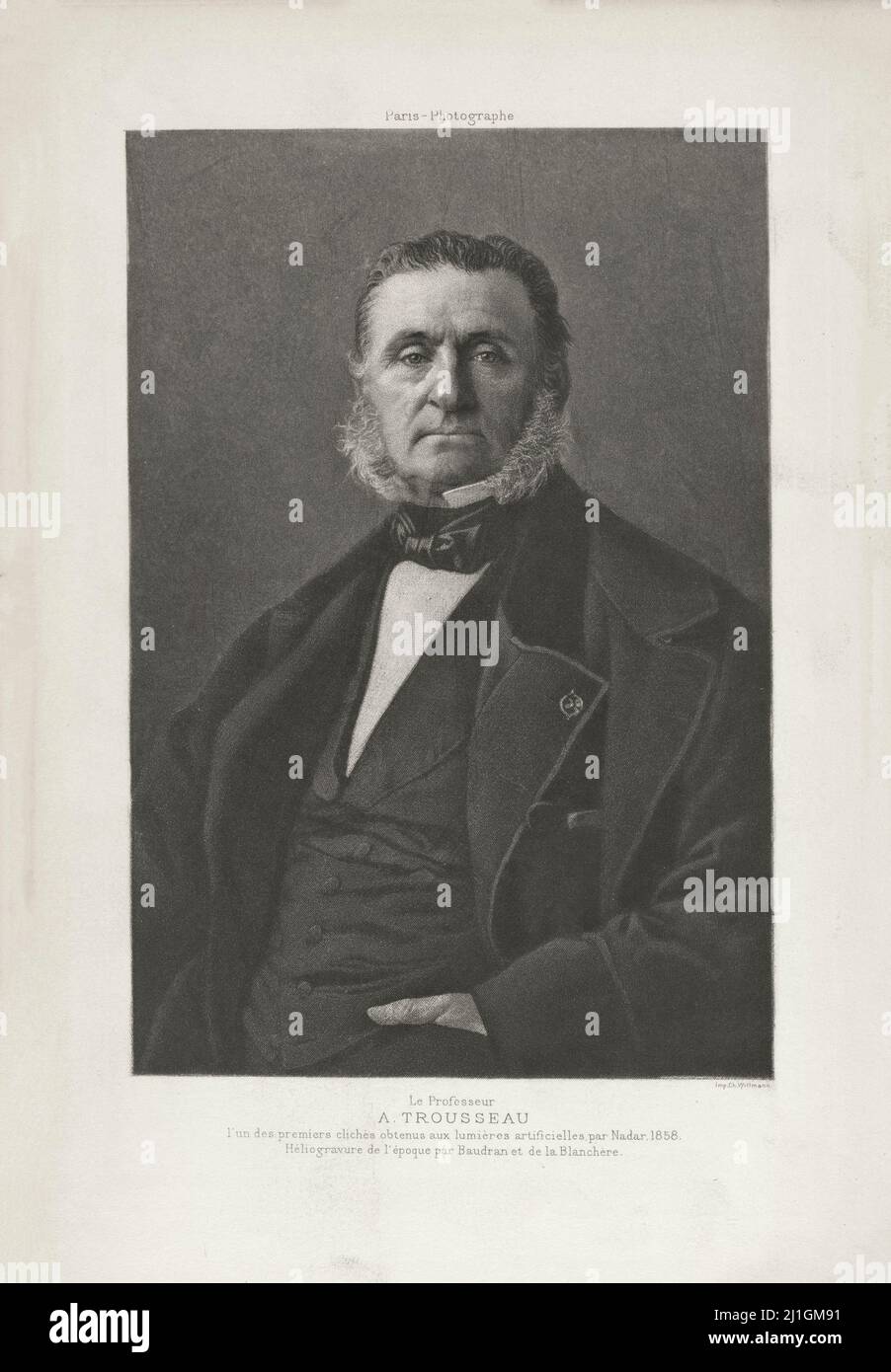 Trousseau sign of latent tetany hi-res stock photography and images - Alamy