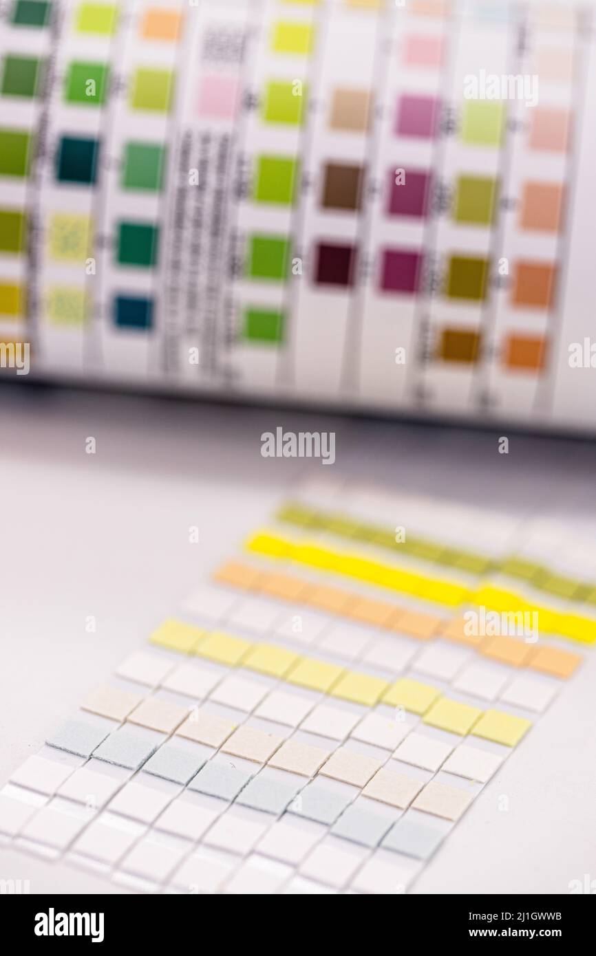 reagent strips used in urinalysis to analyze Leukocytes, Urobilinogen ...