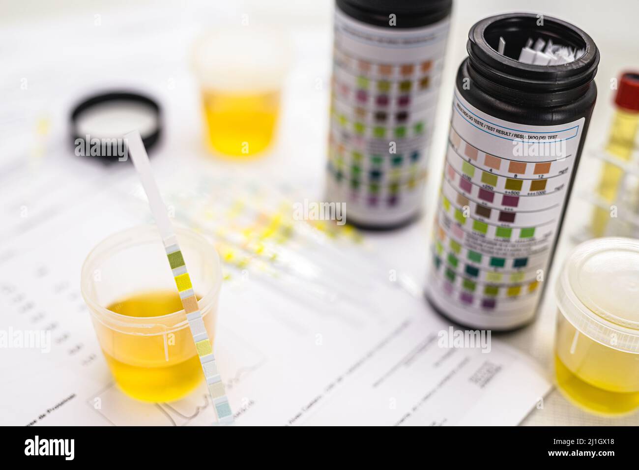 full urine bottle with reagent strip used in urinalysis, bottle with ...