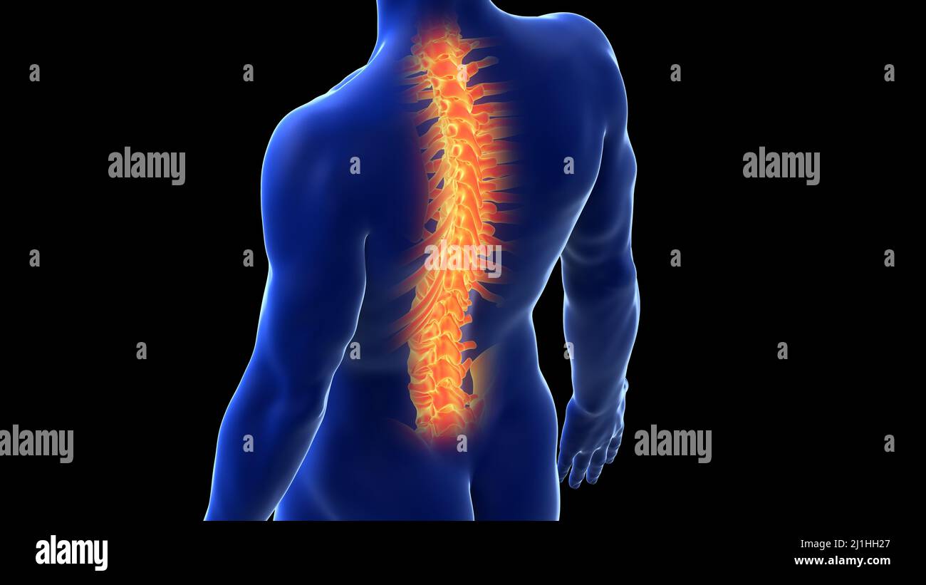 Painful back, illustration Stock Photo - Alamy