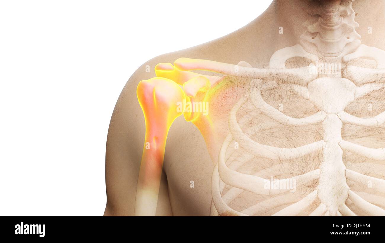 Painful shoulder, illustration Stock Photo - Alamy