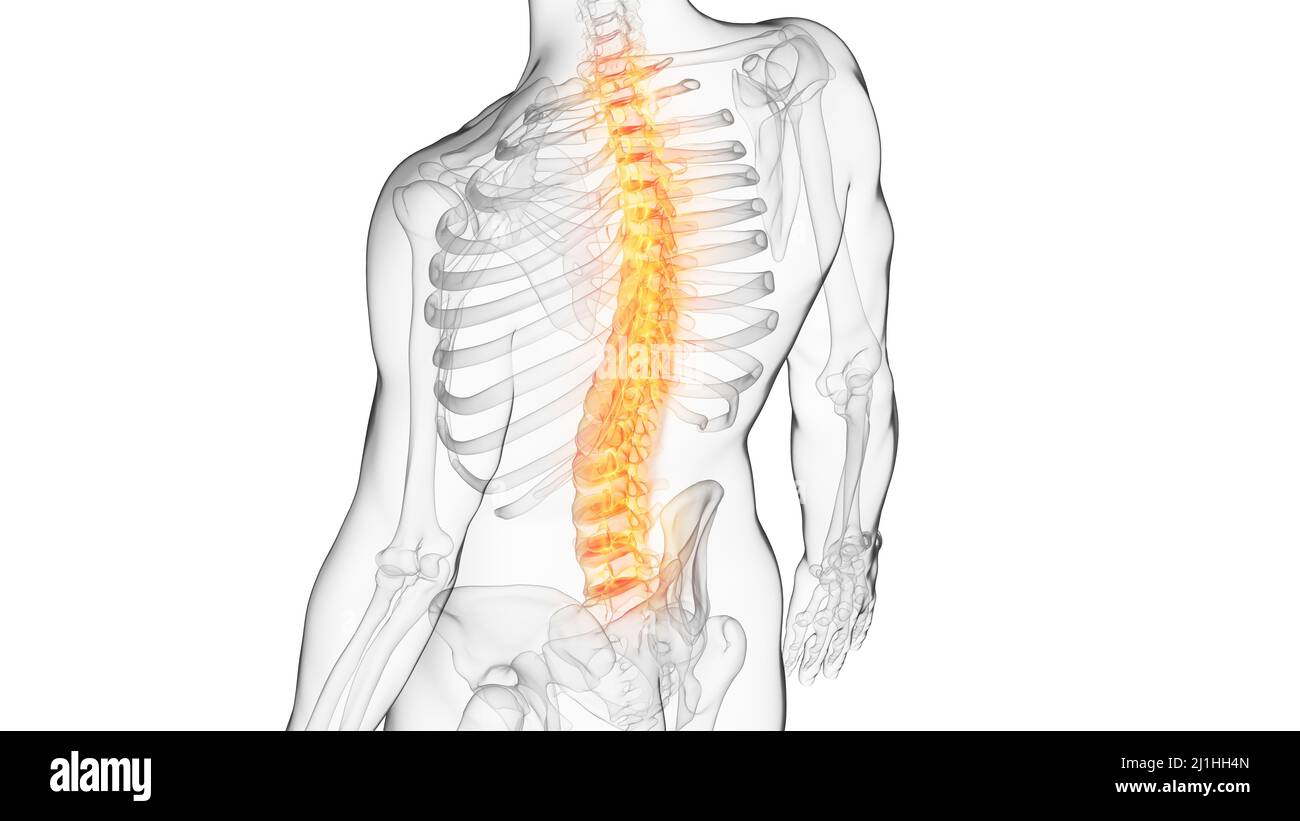 Painful back, illustration Stock Photo - Alamy
