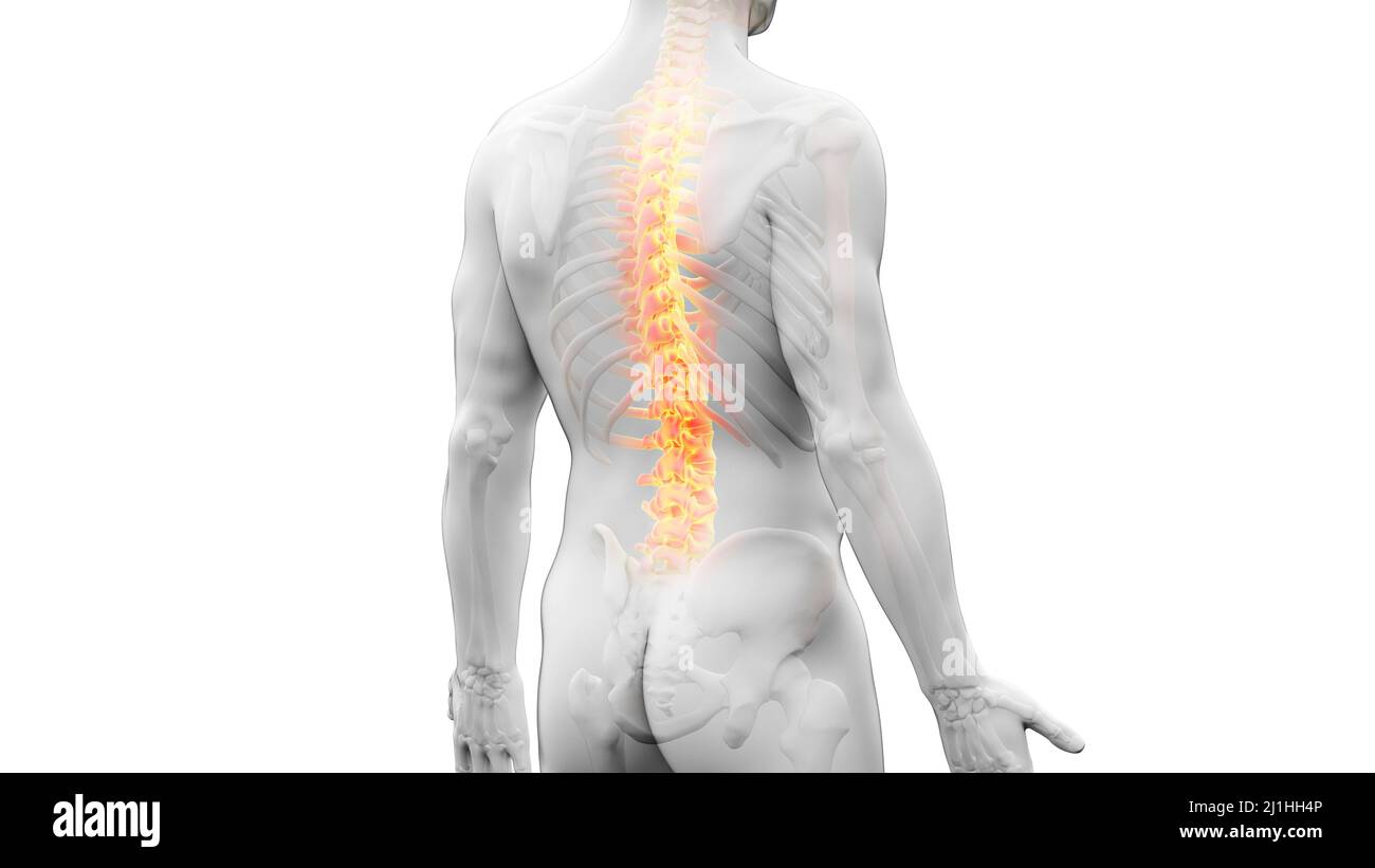 Painful back, illustration Stock Photo - Alamy